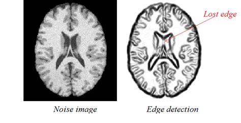 Matlab Best Method To Find Edge Of Noise Image Stack Overflow