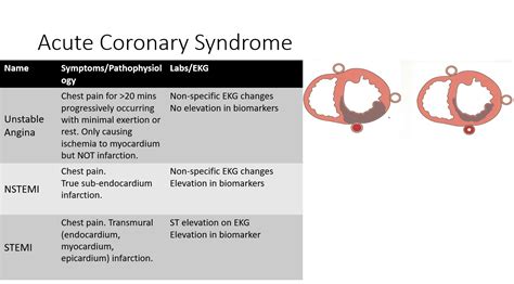 Vasospastic Angina Scvmc Im Chief Resident Blog