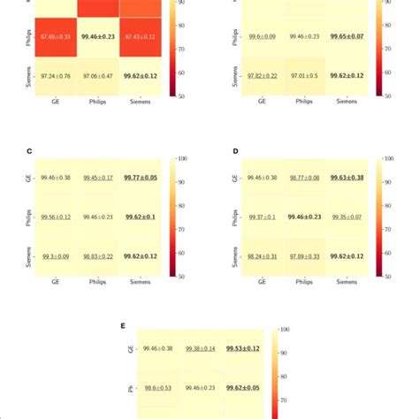 Figure Representative Sample Wm Gm Csf Segmentation Generated By The
