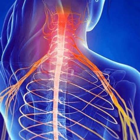 Physiotherapy For Nerve Compression And Pinched Nerves My Pain Clinic