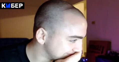 Вмятина на голове от наушника последствия почему остается вмятина от наушников