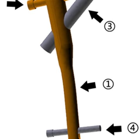 The Three‐dimensional Model Of The New Type Of Proximal Femur Bionic