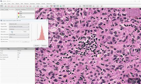 Using Qupath To Help Identify An Optimal Threshold For A Deep Or Machine Learning Classifier