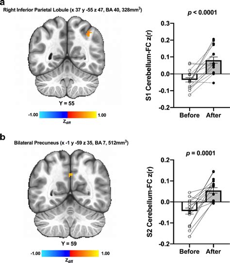 Resting State Functional Cerebellum Connectivity Was Increased From