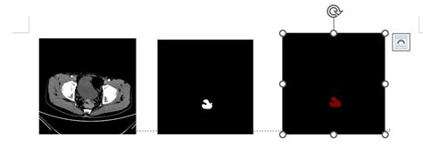 求解slicer图像处理方法 问题求助 3dslicer中文论坛
