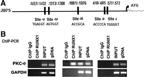 Platelet Protein Kinase C θ Deficiency With Human Runx1 Mutation