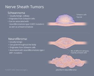 Peripheral Nerve Surgery Department Of Neurosurgery