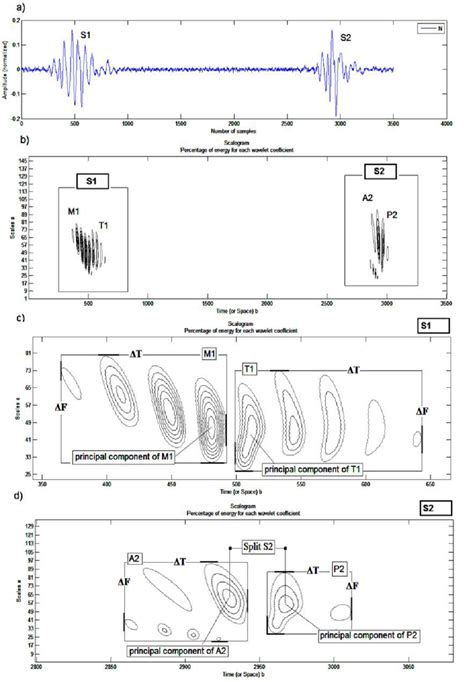 Analysis By The Continuous Wavelet Transform Of A Pcg Normal Signal Download Scientific Diagram