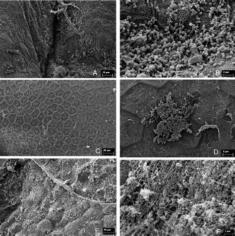 Scanning Electron Microscope Sem Pictures Of The Dorsal Skin Of Three Scanning Electron Microscope Sem Pictures Of The Dorsal Skin Of Three
