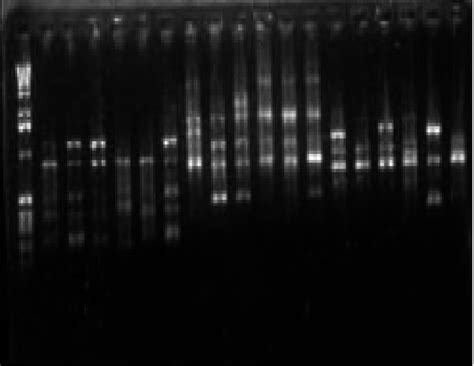 Electrophoretic Analyses Of DNA Amplification Products With Primer Download Scientific Diagram