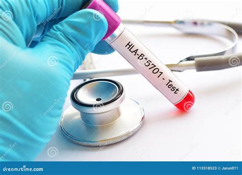 Blood Sample For HLA B Test Stock Image Image Of Gene Antiretroviral