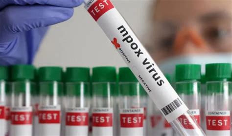 WHO Approves First Mpox Test For Quick Diagnosis