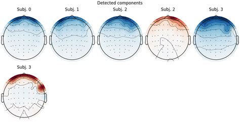 Repairing Artifacts With Ica — Mne 1 8 0 Documentation