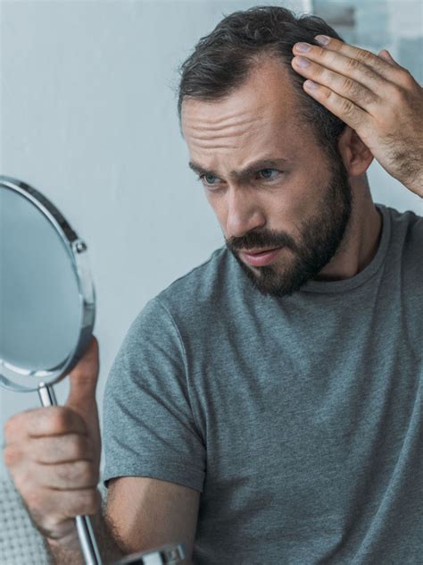 Hair Loss Guide Types Causes And Treatments Hera Hair Clinic