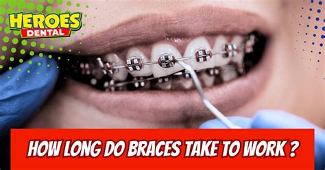 How Long Do Braces Take To Work Heroes Dental