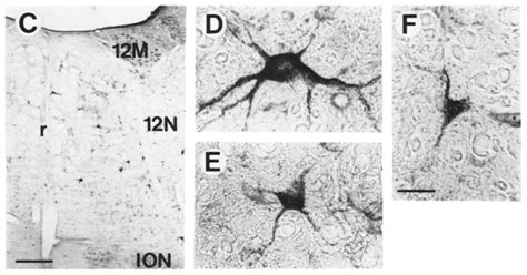 Retrograde Labeling Of Neurons In The Ipsilateral Prn B F After Download Scientific Diagram