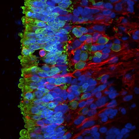 Worldselfieday Stemcellfie Fluorescencefriday Stemcell Technologies