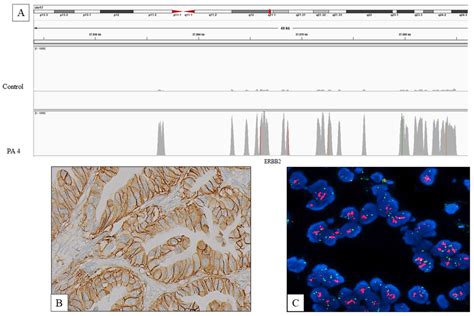 a her2 copy number analysis by integrative genomics viewer igv download scientific diagram
