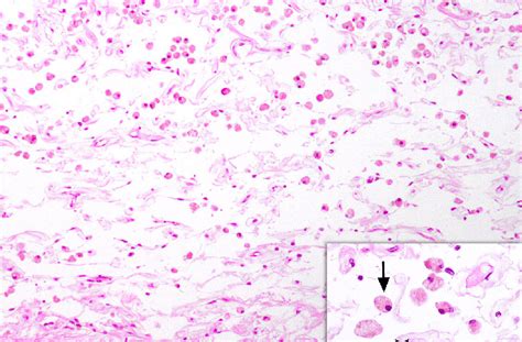 Histopathology Of The Telencephalic Cortex Of Sheep 8 Recovered From