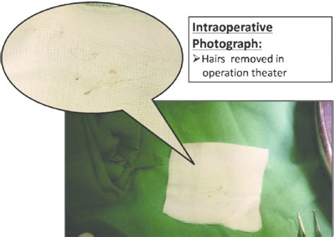 Intraoperative Photograph Download Scientific Diagram