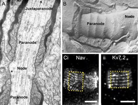Structural Organization Of The Node Of Ranvier A Ultrastructure Of Download Scientific