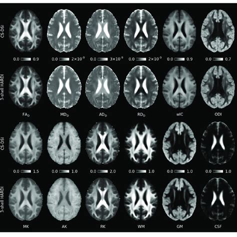 Dmri Sampling Distributions And Diffusion Weighting Of The Advanced