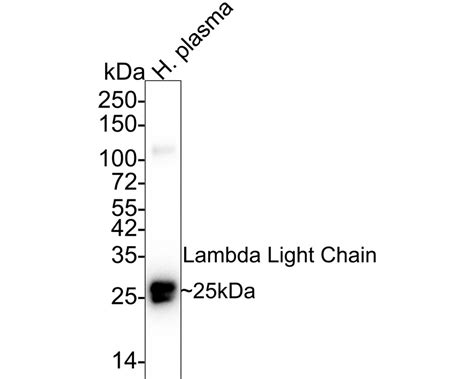 Lambda Light Chain Recombinant Mouse Monoclonal Antibody A8g3 R Ha6