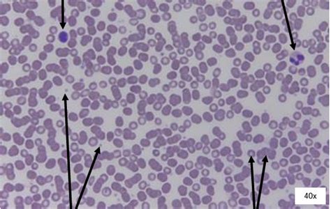 Blood Smear Diagram Quizlet