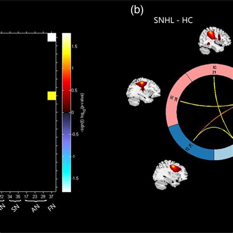 A Matrix Shows Differences Of Internetwork Functional Connectivity
