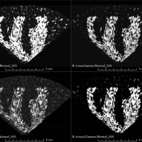 Tissue Characterization For The Gaussian Rayleigh Gamma And