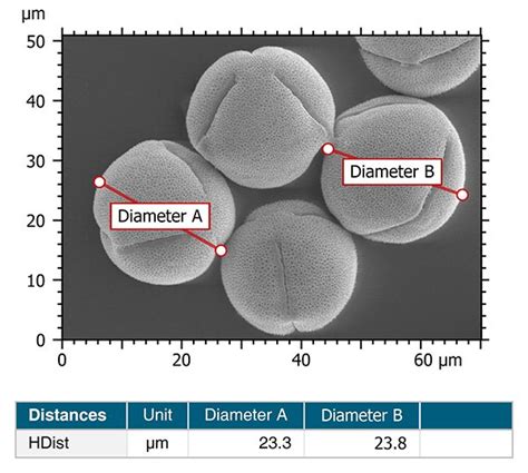 Measure Any Object In A Microscope Image Digital Surf