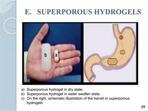 Gastro Retentive Drug Delivery System Grdds Pptx