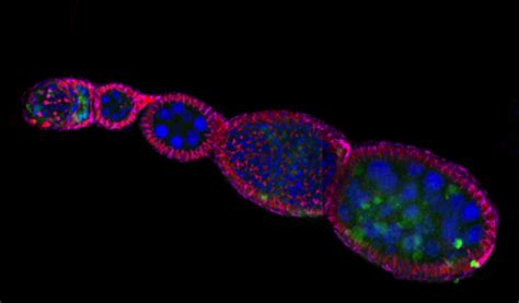 Cancer Stem Cell Models The John Curtin School Of Medical Research
