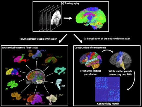 Tractography Segmentation A Example Whole Brain Tractogram Computed Download Scientific