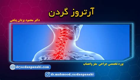 علائم آرتروز گردن روش های درمان آرتروز گردن