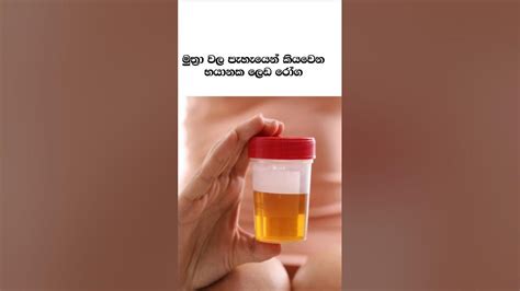 මුත්‍රාවල පැහැයෙන් කියවෙන භයානක ලෙඩ රෝග 😳 ️ Sinhala Facts Health Youtube