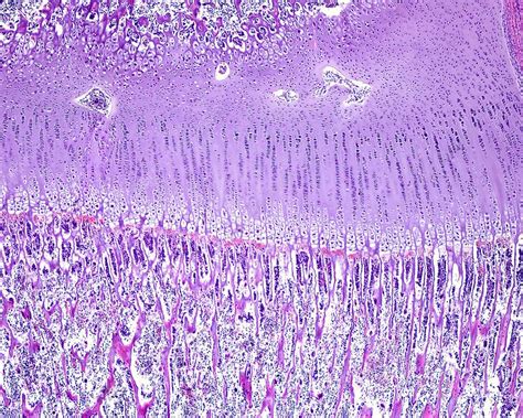 Endochondral Ossification Light Micrograph Stock Image C050 6271 Science Photo Library