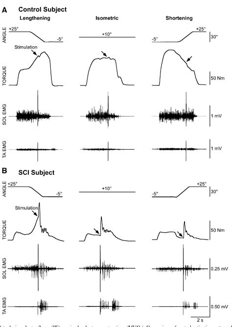 Table 1 From Increased Spinal Reflex Excitability Is Associated With
