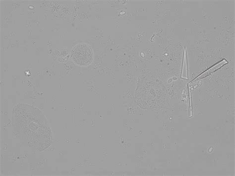 Uric Acid Wedge Shape Cellwiki