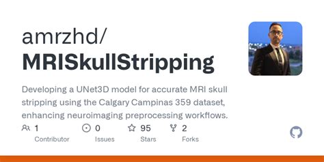 Github Amrzhdmriskullstripping Developing A Unet3d Model For Accurate Smartera Organization