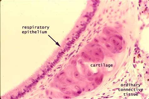 Tracheal Cartilage Histology