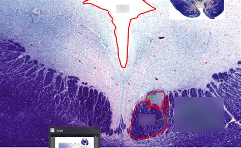 Nuclei Of Caudal Midbrain Diagram Quizlet