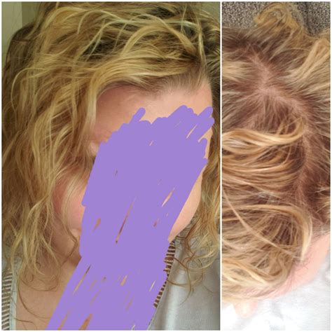 Top Of Head Issues My Hair Doesnt Like The Very Top Of My Head More