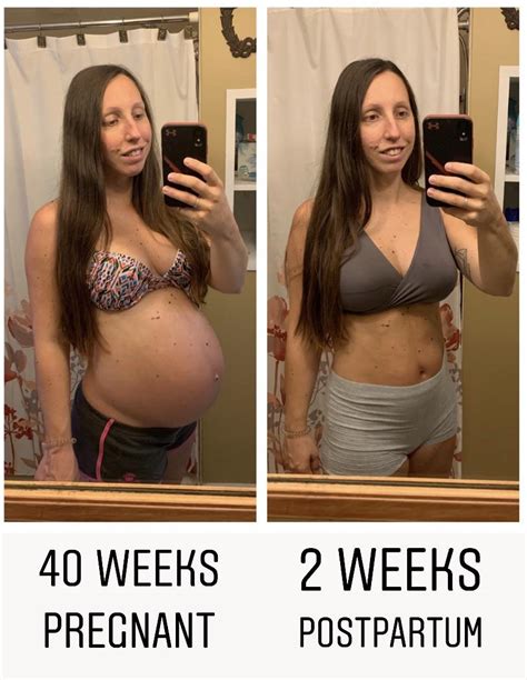 Before And After Pregnancy Belly