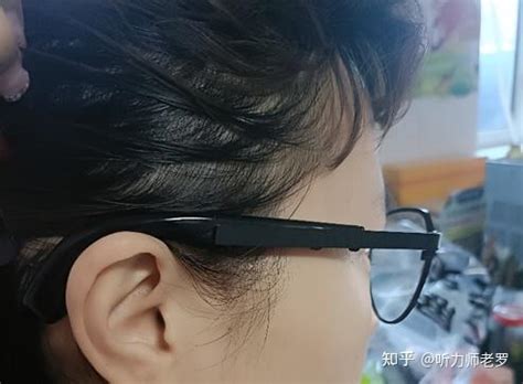 案例分享眼镜骨导技术干预传导性听力损失双侧中耳炎 知乎