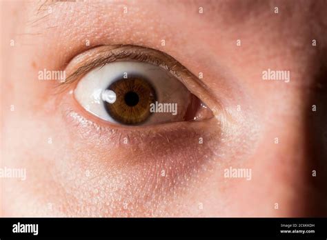 Braune Augen Iris Von Der Iris Spektrum Der Wissenschaft