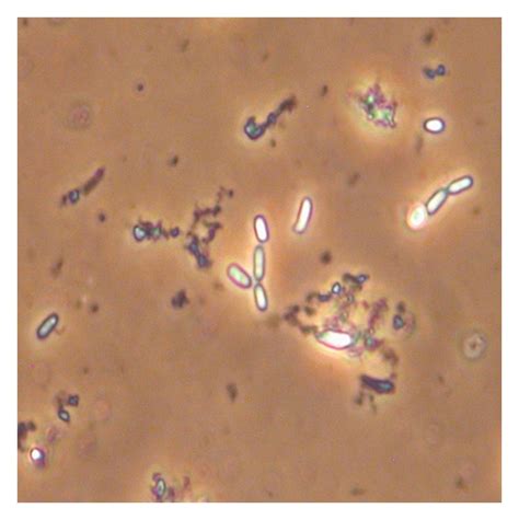 Image Of Spores Classified As Nosema By Phase Contrast Light Download Scientific Diagram