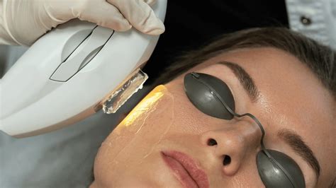 Pigmentation Removal Bovolon Aesthetics