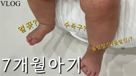 7개월아기 Vlog 고열열꽃 아프지마~~~🤒 육아 브이로그 Youtube