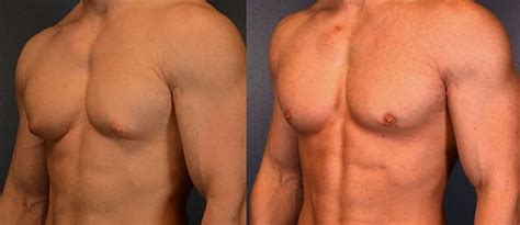 Are Sustanon Safe To Use Sustanon Steroids